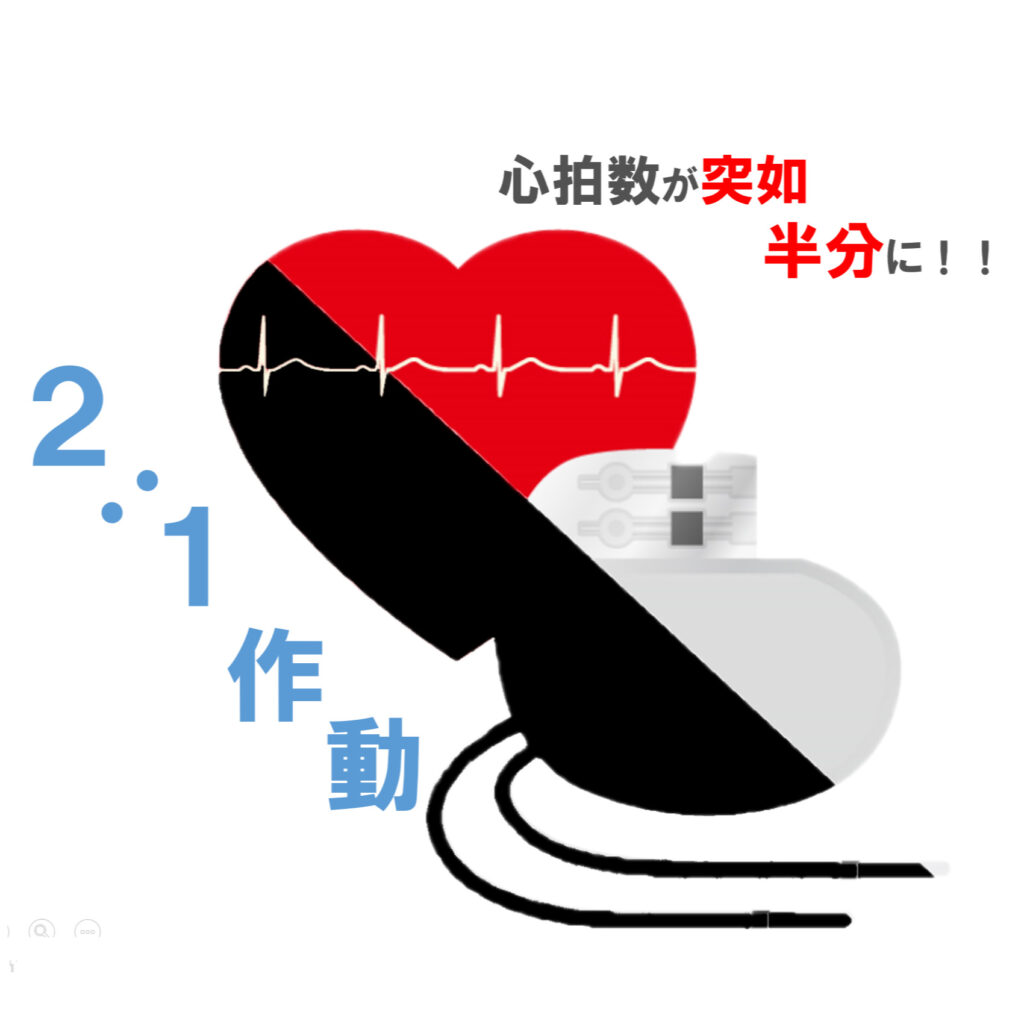 安静時冠血流比の違いについて少し深める【iFR, RFR, dPR,DFR】 | カテっ子臨床工学技士